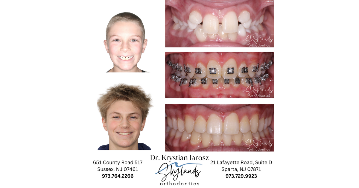 Building Smiles That Last a Lifetime | Sparta, NJ News TAPinto | TAPinto