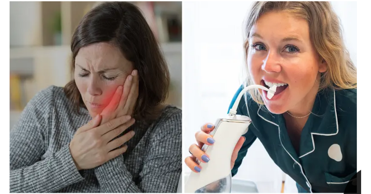 Miracle Smile Reviews [CONSUMER REPORTS]: All You Need To Know About ...