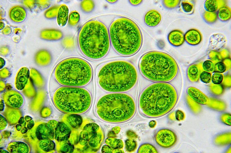 Rutgers Student Turns Microorganisms Into Works of Art | TAPinto