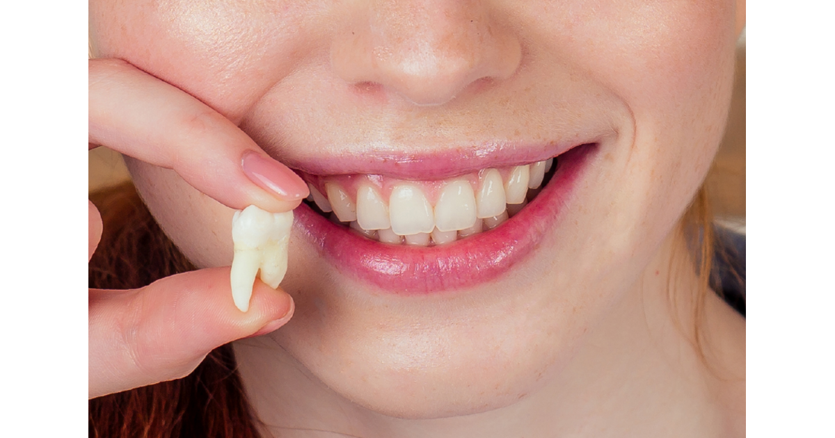 Why Do We Have Wisdom Teeth, And Do They Still Serve a Role? | Wayne ...